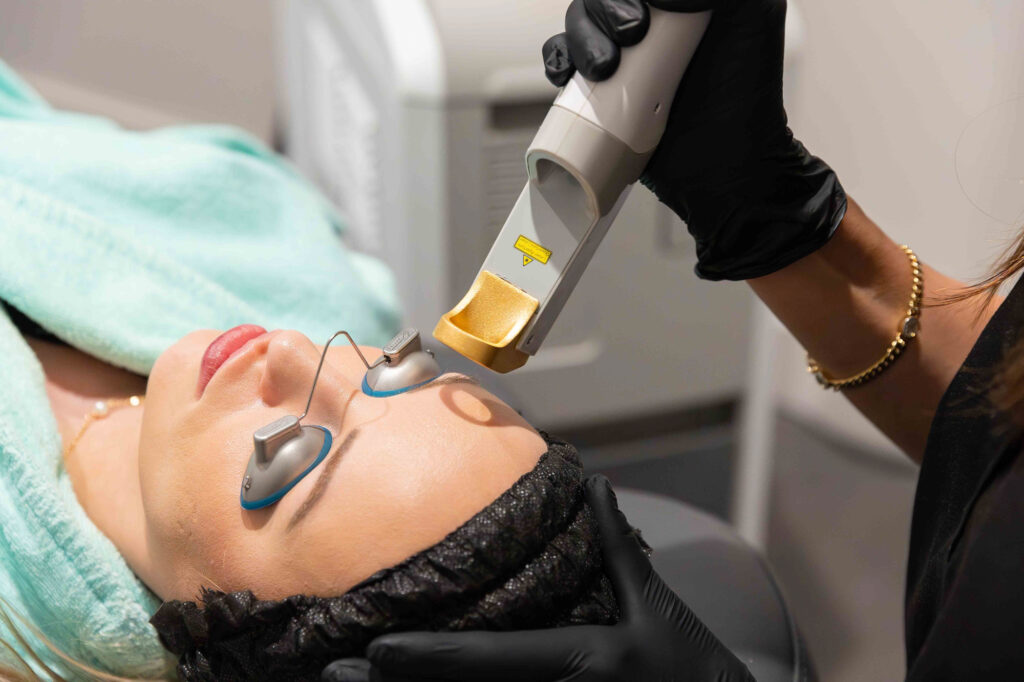 Laser Skin Resurfacing in Homewood, AL - Smart Skin